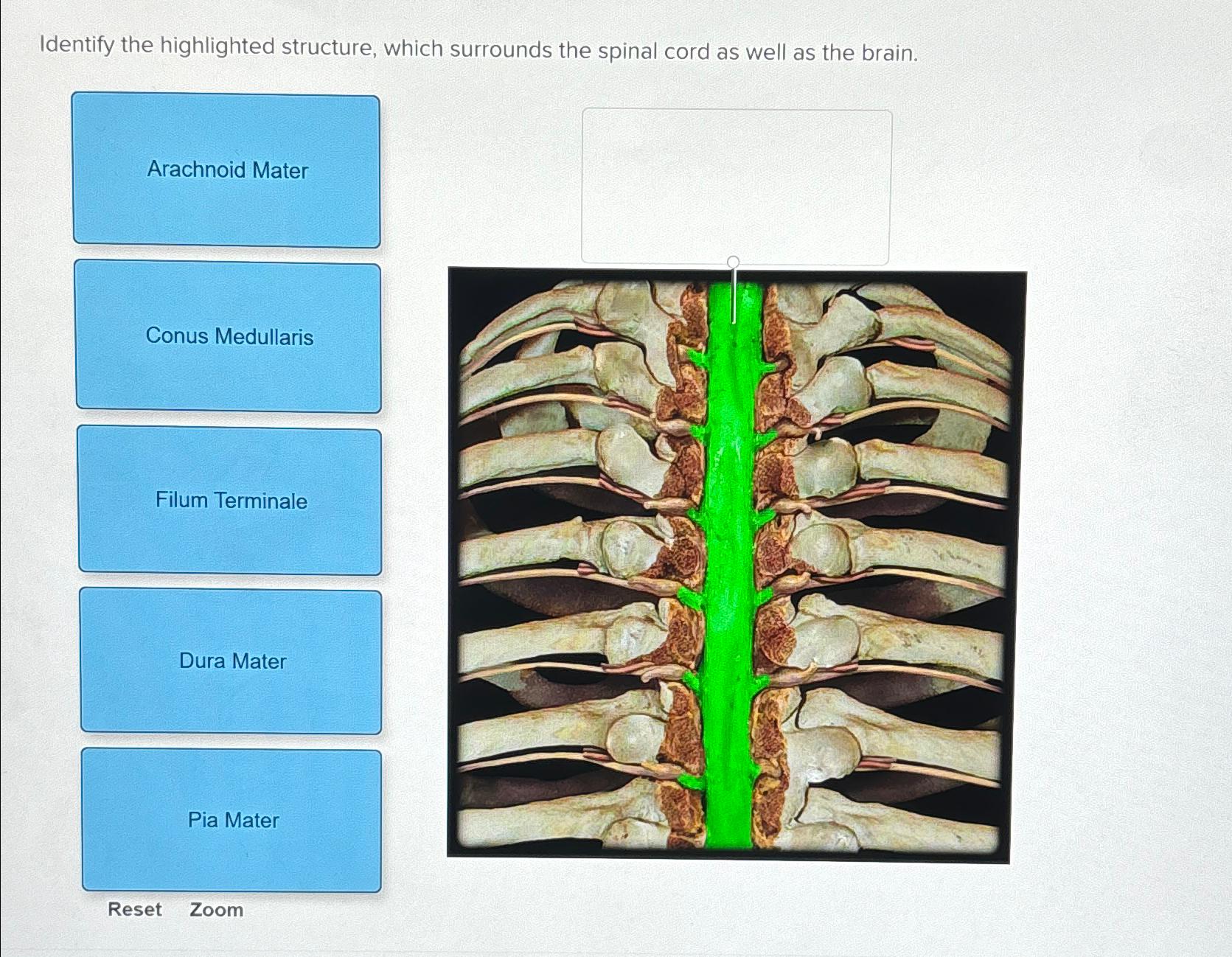 Solved Identify the highlighted structure, which surrounds | Chegg.com