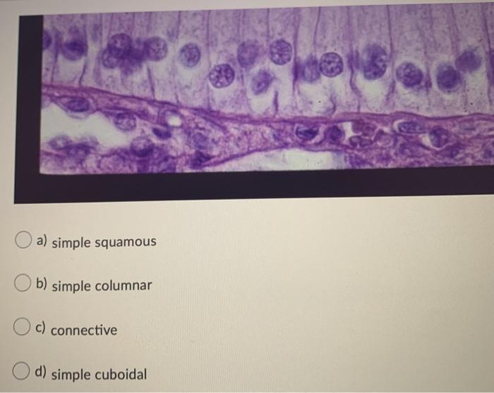 Solved a) simple squamous b) simple columnar c) connective | Chegg.com