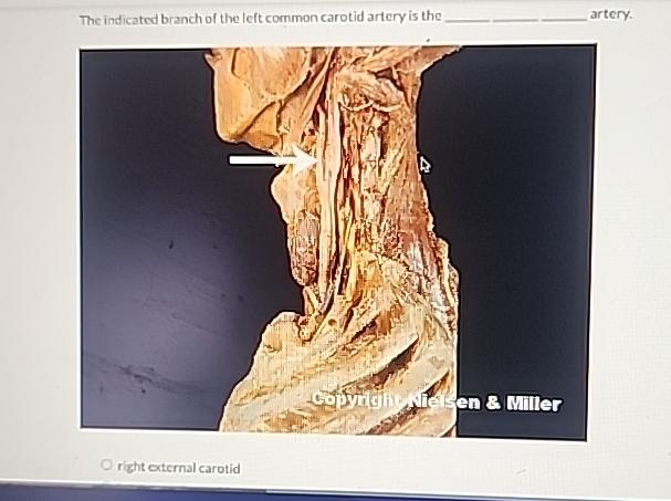 Solved The indicated branch of the left common carotid | Chegg.com