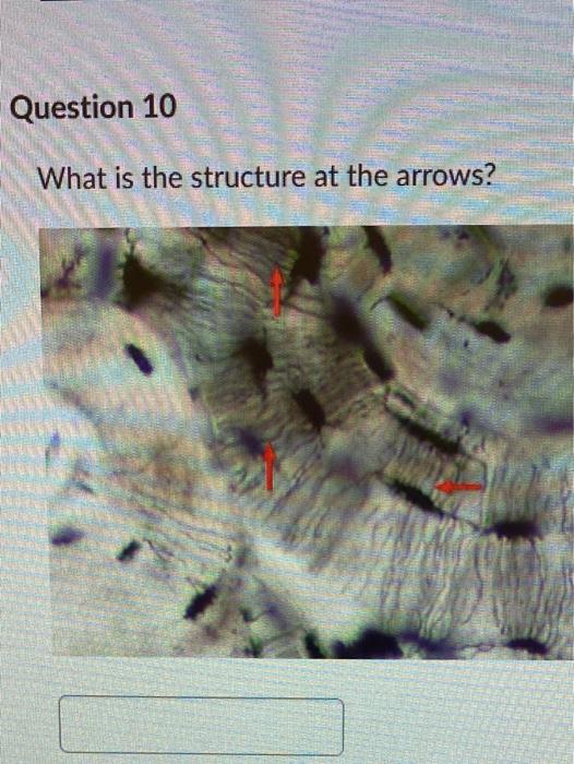 Solved Question 10 What is the structure at the arrows? | Chegg.com