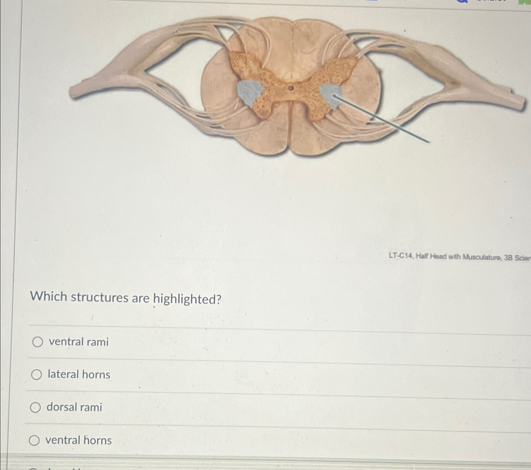 Solved LT-C14, ﻿Half Head with Musculature, 38 ﻿ScleWhich | Chegg.com