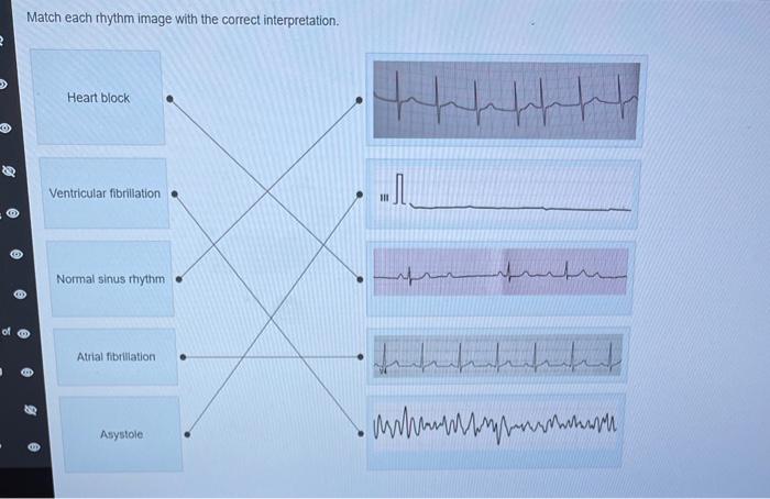 Solved Match each rhythm image with the correct | Chegg.com