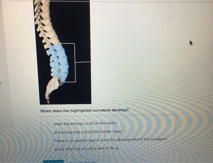 Solved When does the highlighted curvature develop? when the | Chegg.com