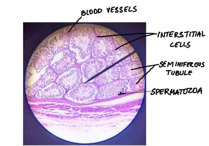 Solved Label and indicate Septa onto Testis photo: indentify | Chegg.com