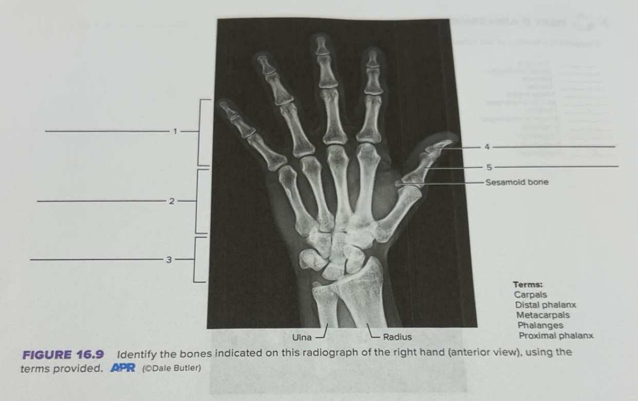 Solved FIGURE 16.9 ﻿Identify the bones indicated on this | Chegg.com