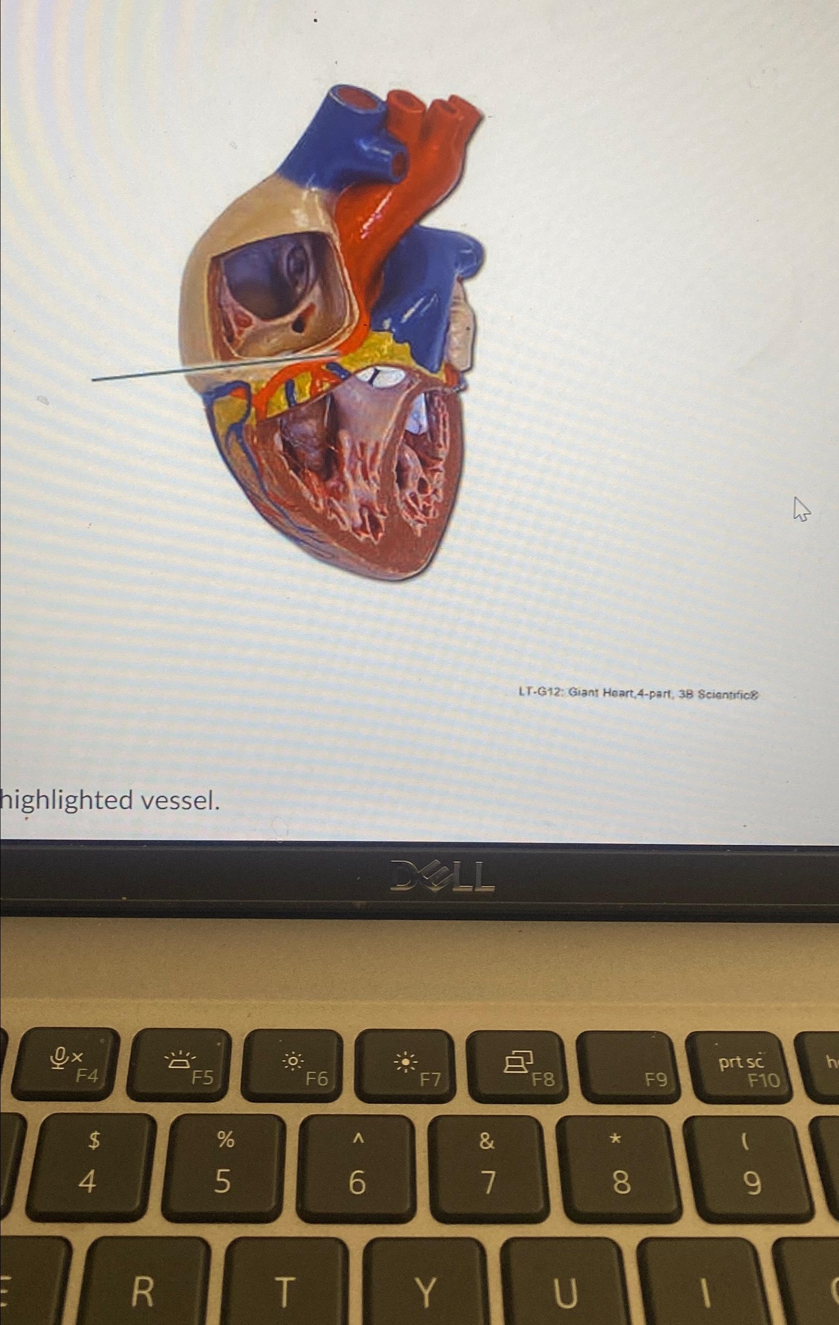 Solved LT-G12: Giant Heart,4-part, 38 | Chegg.com