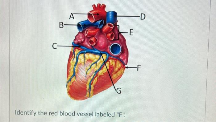 Solved Identify blood vessel "D". Identify structure | Chegg.com