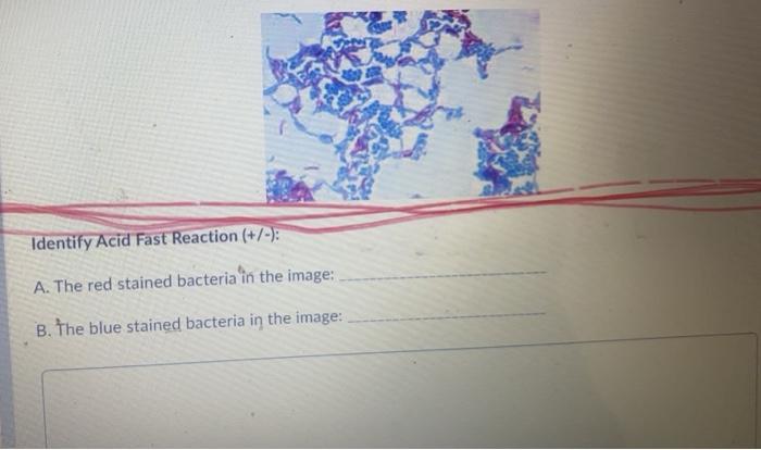 Solved Identify Acid Fast Reaction (+/-): A. The red stained | Chegg.com