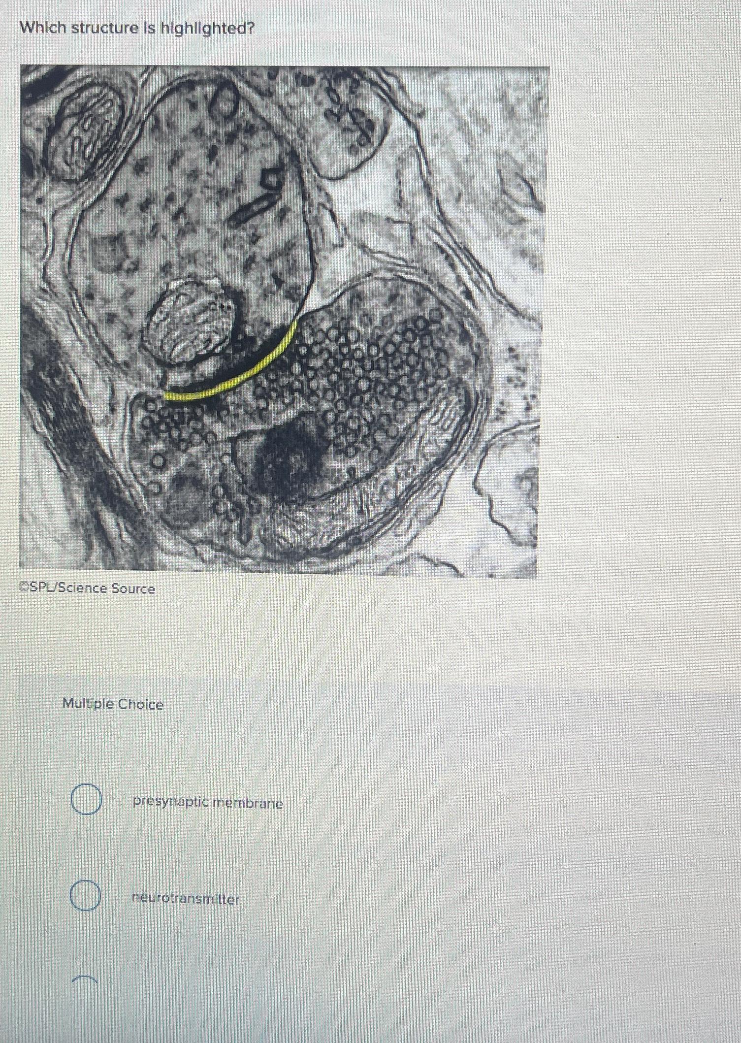 Solved Which structure Is highlighted?SPLUScience | Chegg.com