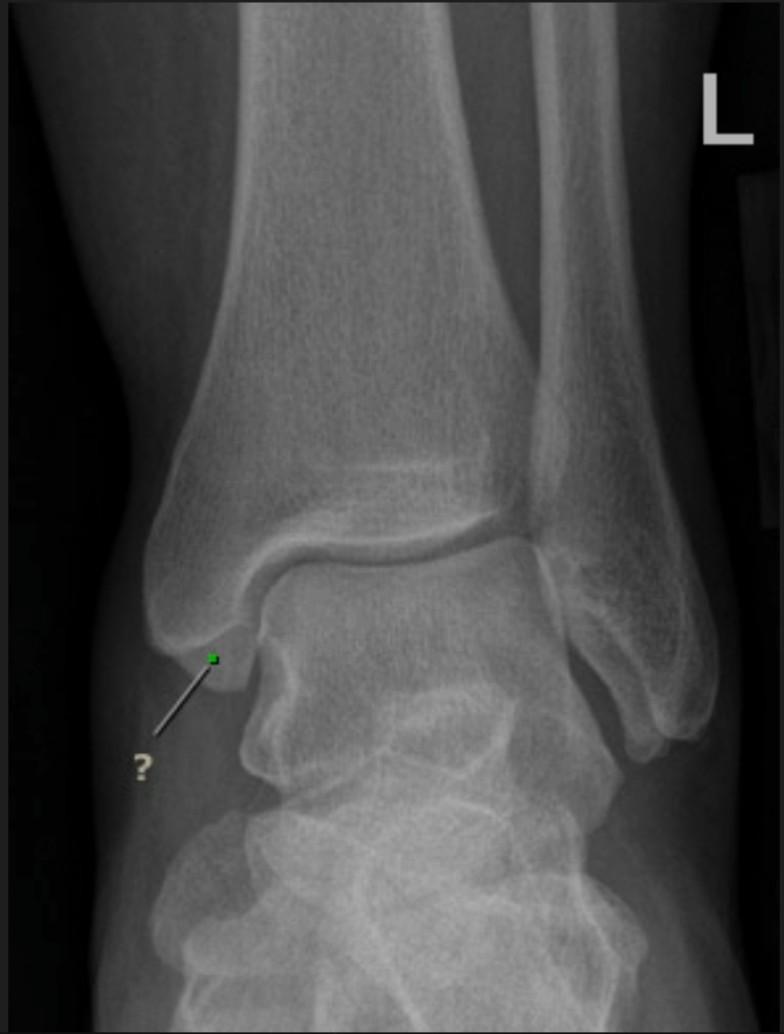 Solved identify the following structures that are pointed | Chegg.com