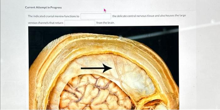 Solved Current Attempt in Progress The indicated cranial | Chegg.com