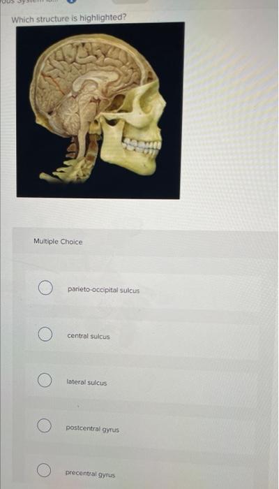 Solved Which structure is highlighted? wall Multiple Choice | Chegg.com