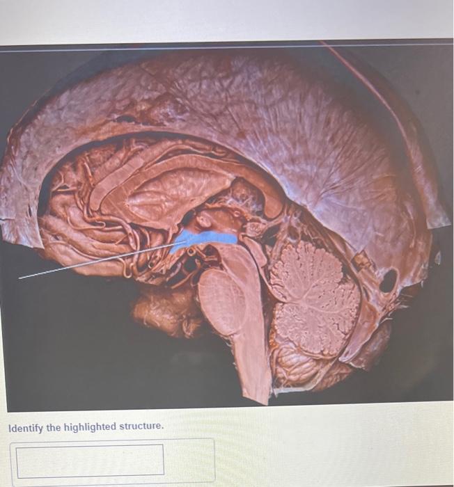 Solved Identify the highlighted structure. | Chegg.com Solved Identify the highlighted structure. | Chegg.com