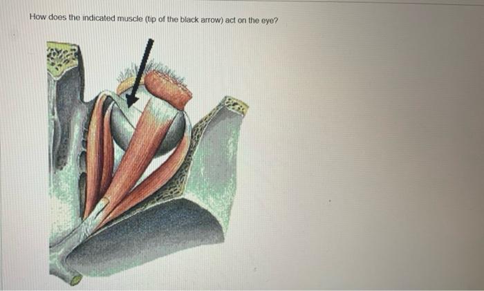 Solved Tho indicated lobe (tip of black arrow) is: A. | Chegg.com
