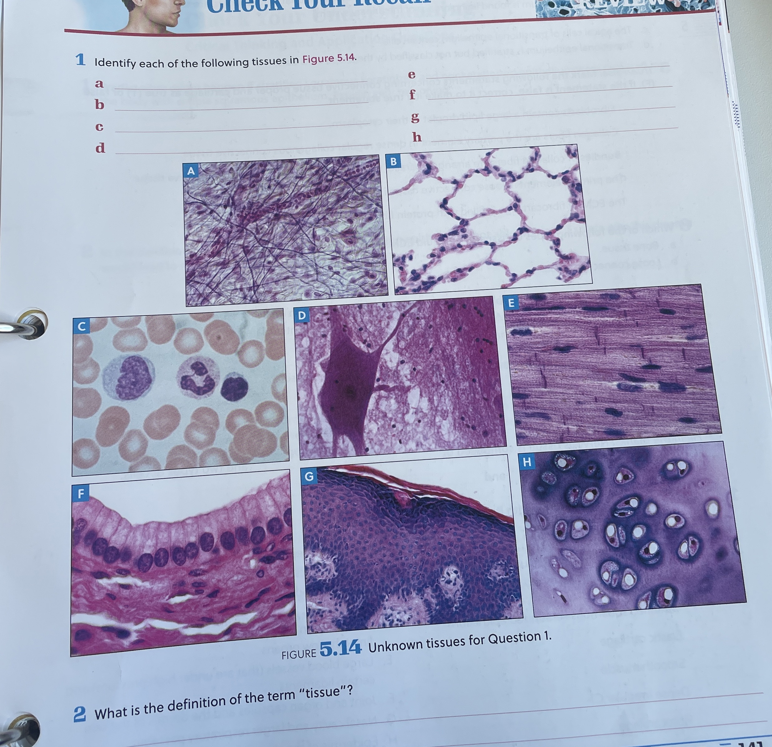 Solved 1 ﻿Identify each of the following tissues in Figure | Chegg.com
