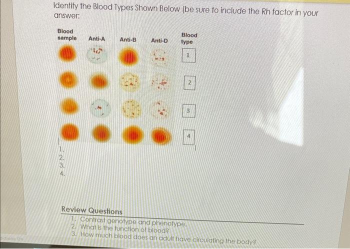 Solved Identify the Blood Types Shown Below (be sure to | Chegg.com