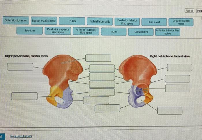 Solved Reset Help Obturator foramen Lesser sciatic notch | Chegg.com
