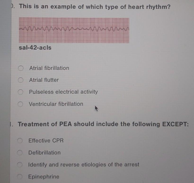 Solved D. This is an example of which type of heart rhythm? | Chegg.com