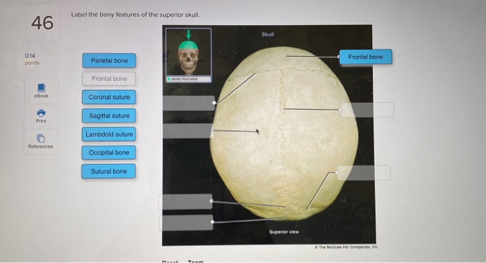 Solved Label the bony features of the superior skull 46 | Chegg.com