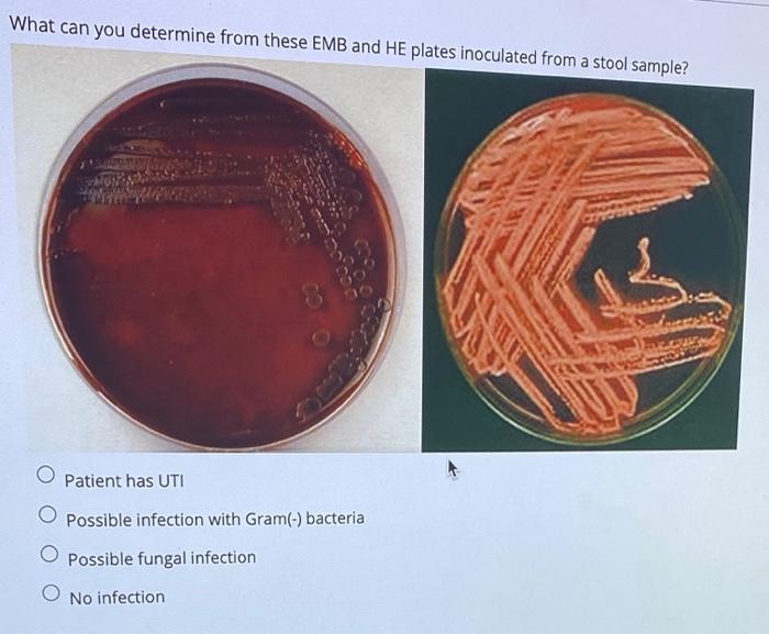 Solved What can you determine from these EMB and HE plates | Chegg.com
