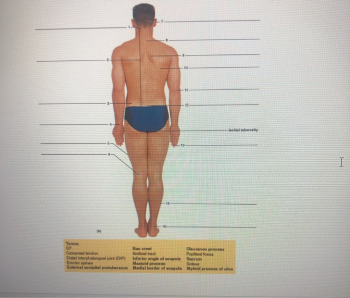 Solved FIGURE 26.9 Using the terms provided, label the | Chegg.com
