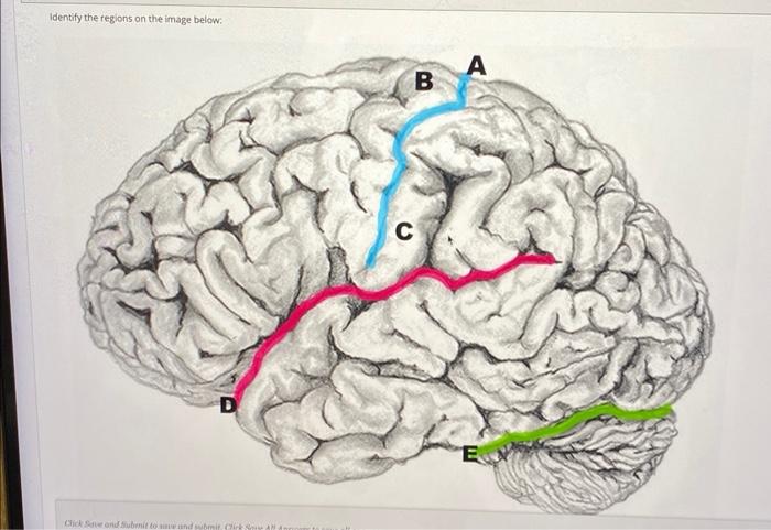 Solved Identify the regions on the image below: A. Blue | Chegg.com