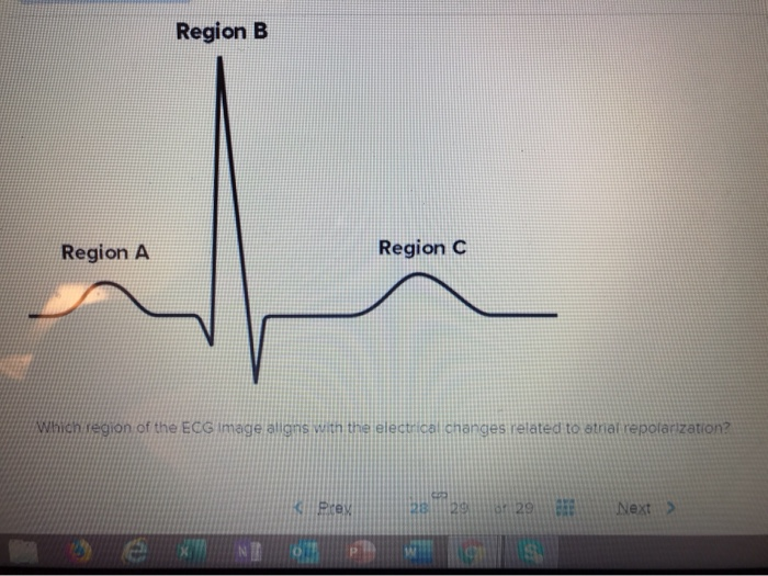 Solved which region of the ECG image aligns with the | Chegg.com
