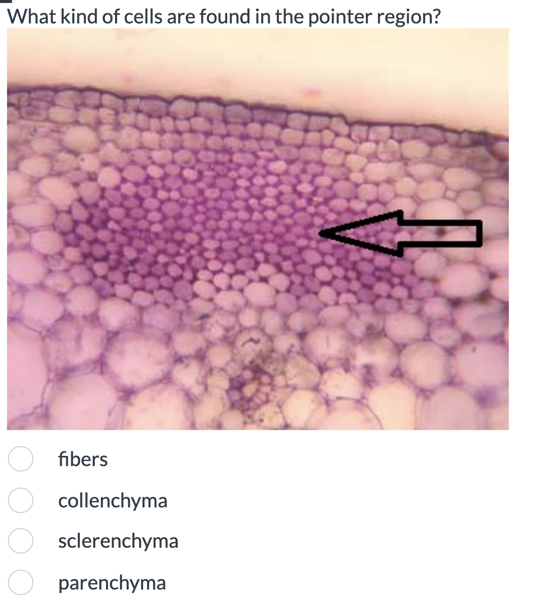 Solved What kind of cells are found in the pointer | Chegg.com