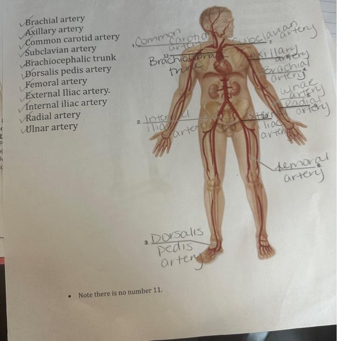 Solved Brachial artery Axillary artery Common carotid artery | Chegg.com