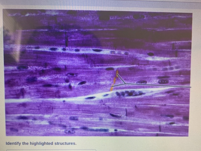Solved Identify the highlighted structures. | Chegg.com