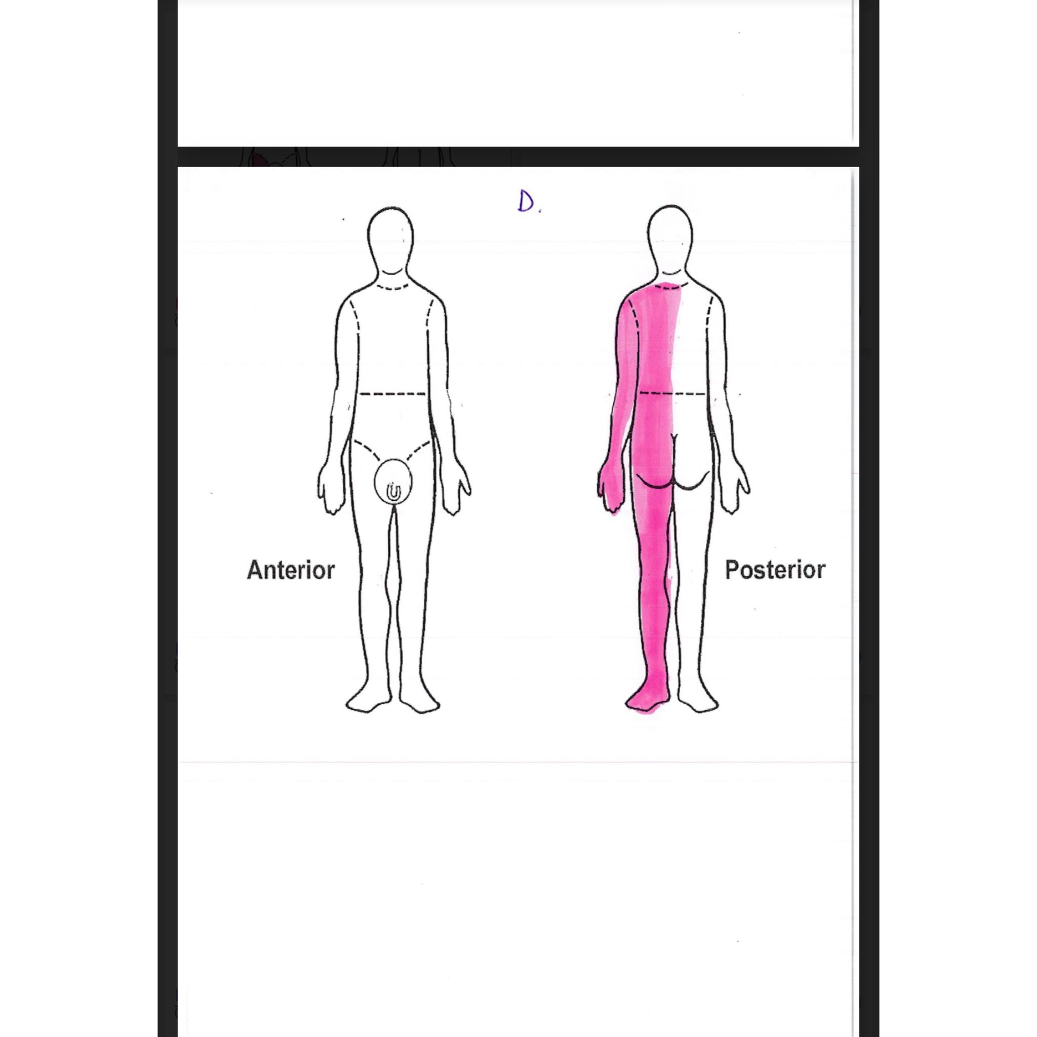 Solved Rule of 9 ﻿percent for shaded area | Chegg.com