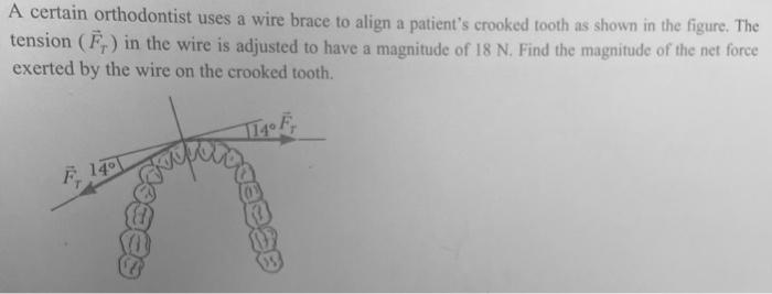 Solved A certain orthodontist uses a wire brace to align a | Chegg.com Solved A certain orthodontist uses a wire brace to align a | Chegg.com