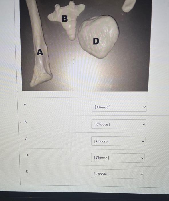 Solved E С B D A A [Choose B Choose B D А >> [Choose > B I | Chegg.com