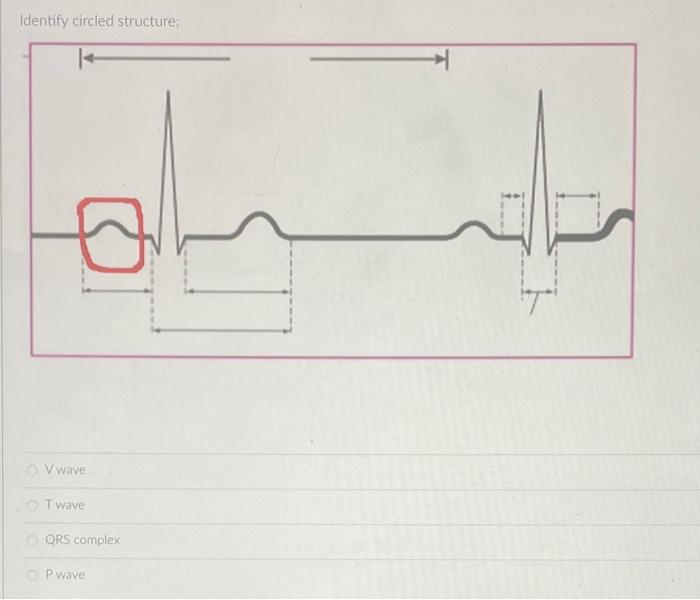 Solved Identify circled structure: V wave Twave P wave QRS | Chegg.com
