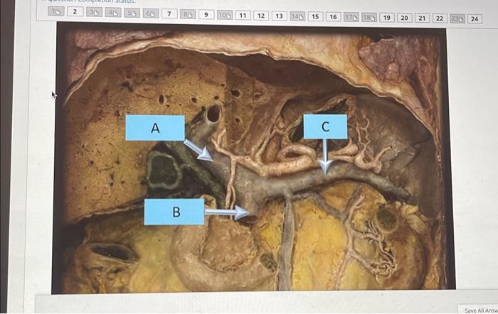 Solved label the blood vessels of the hepatic portal system | Chegg.com