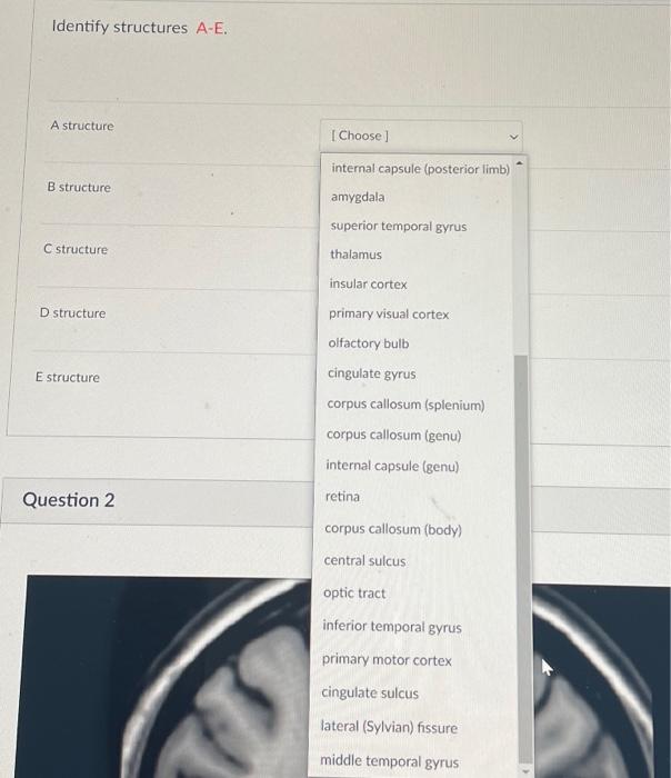 Solved A D (В B C Identify structures A-E. A structure [ | Chegg.com