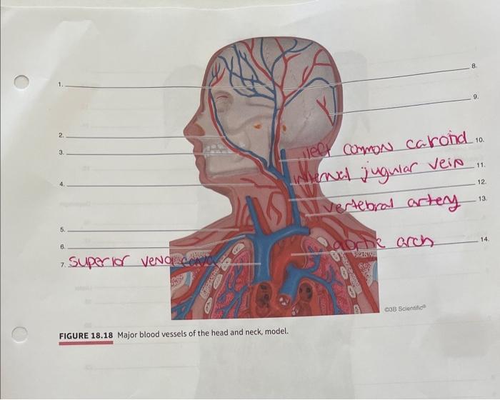 Solved FIGURE 18.18 Major blood vessels of the head and | Chegg.com