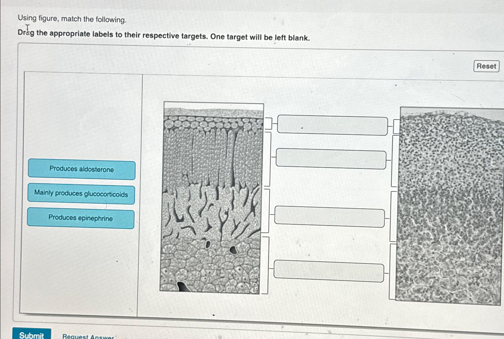 Solved Using figure, match the following.Dr:g the | Chegg.com