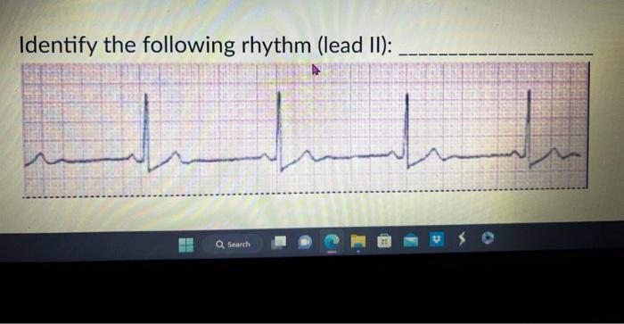 Solved Identify the following rhythm (lead II): | Chegg.com