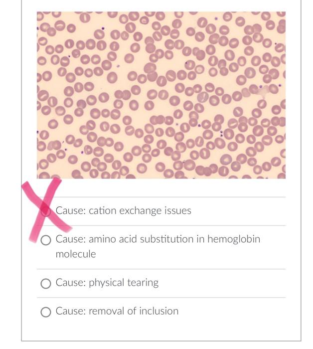 Solved Morphology: stomatocytes Morphology: schistocytes | Chegg.com