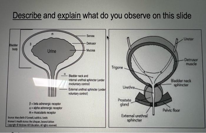 Solved Describe and explain what do you observe on this | Chegg.com
