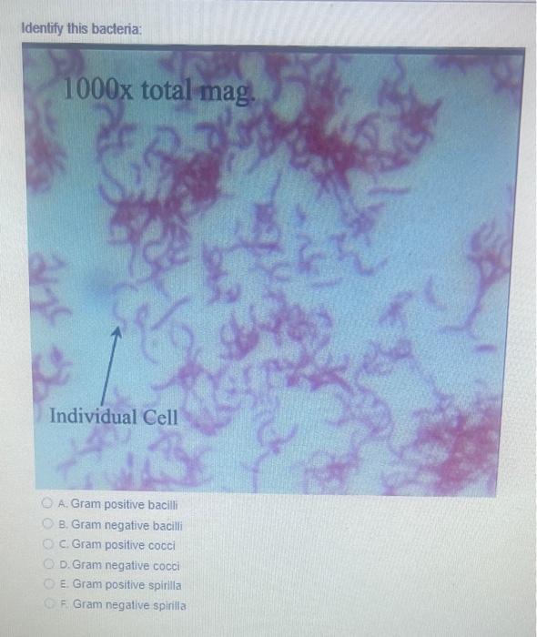 Solved A. Gram positive bacilli B. Gram negative bacilli C. | Chegg.com