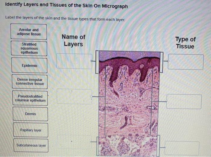 Solved Identify Layers and Tissues of the Skin On Micrograph | Chegg.com