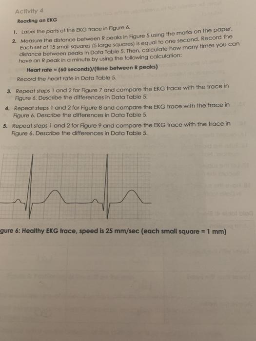 Solved Activity 4 Reading an EKG 1. Label the parts of the | Chegg.com