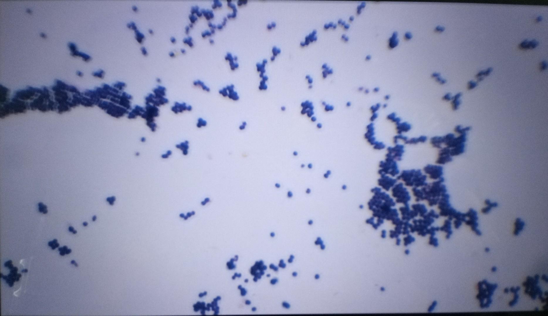 Solved Alcaligenes viscolactis Bacillus | Chegg.com