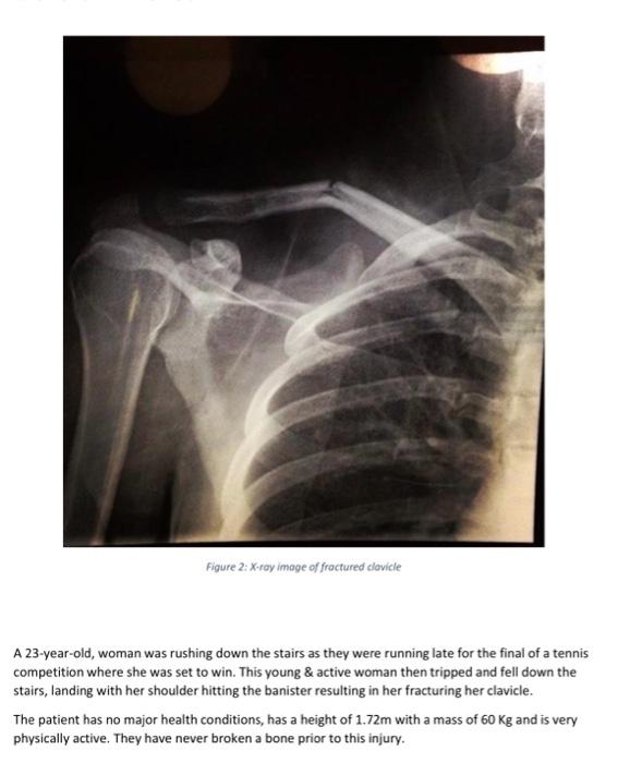 Produce a free body diagram (FBD) of the chosen | Chegg.com