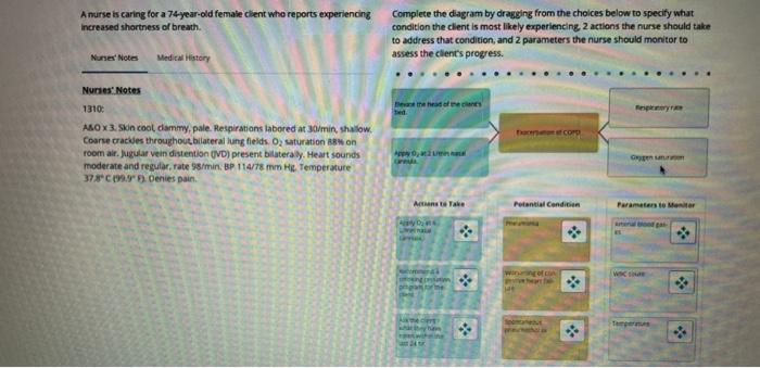 Solved A nurse is caring for a 74-year-old female client who | Chegg.com