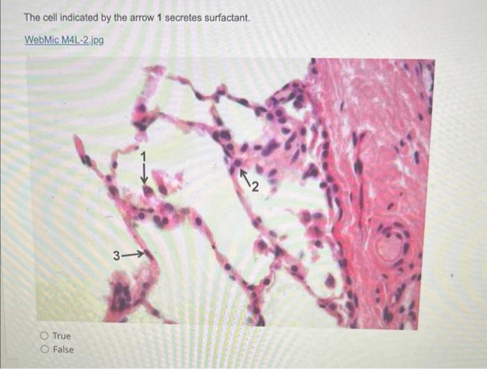 of theol hievened with bandt of mooth matal stain | Chegg.com