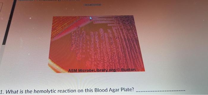 Free ASM MicrobeLibrary.org Buxton 1. What is the | Chegg.com