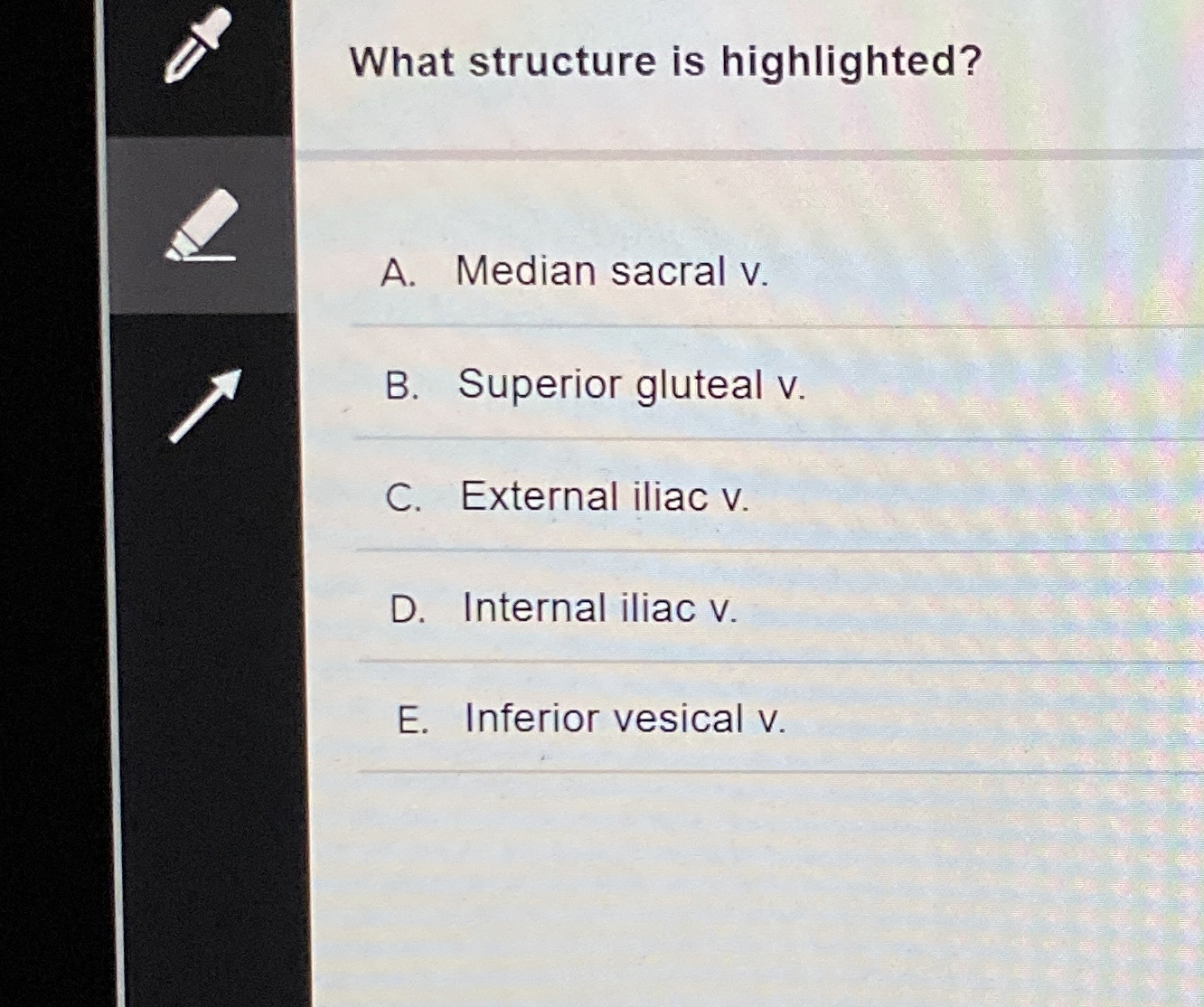 Solved What structure is highlighted?A. ﻿Median sacral v.B. | Chegg.com
